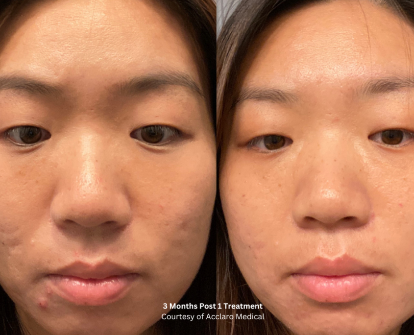 Gallery | UltraClear