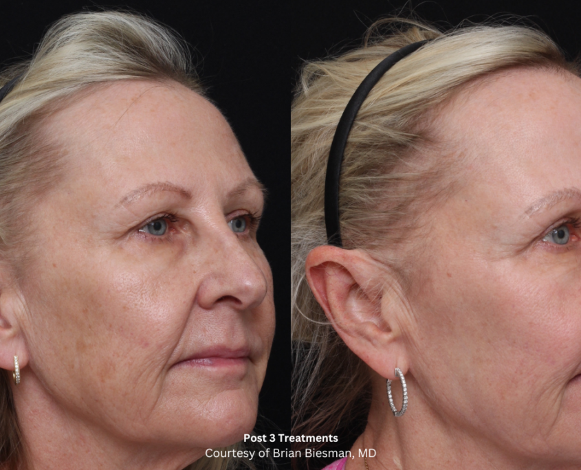 Gallery | UltraClear